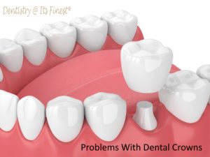 10 Common Problems With Dental Crowns - Dentistry At Its Finest